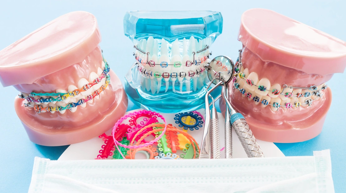 Types of Braces: Their Unique Functions, Benefits, and More!