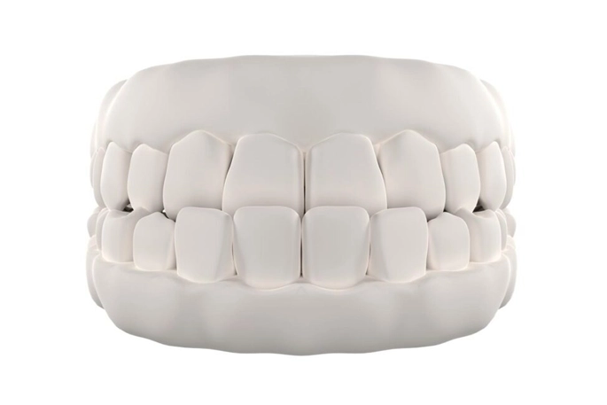 Underbite Teeth: How to Fix, Types Causes & Treatments