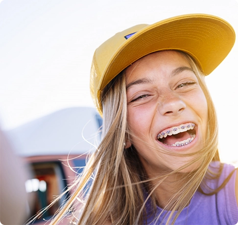 Transform Your Smile with Advanced Metal Braces!